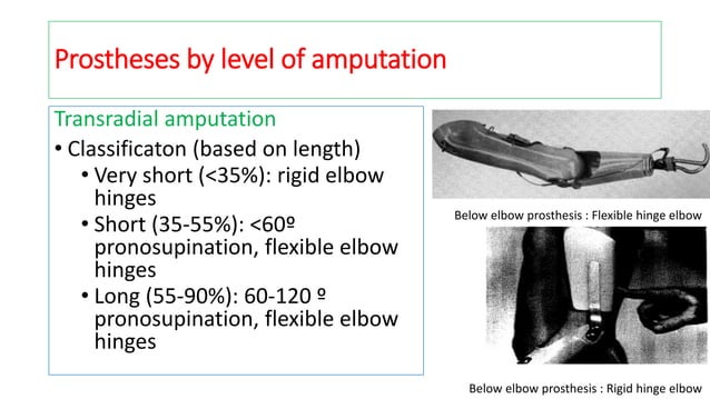 Upper Limb Prosthetics - Dr Om Prakash | PPTX | Physical Therapy | Wellness