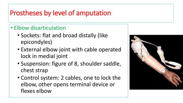 Upper Limb Prosthetics - Dr Om Prakash | PPTX | Physical Therapy | Wellness