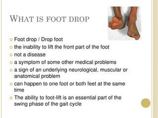 DROP_FOOT_AND_TREATMENTS. — The various treatment approaches which are ...