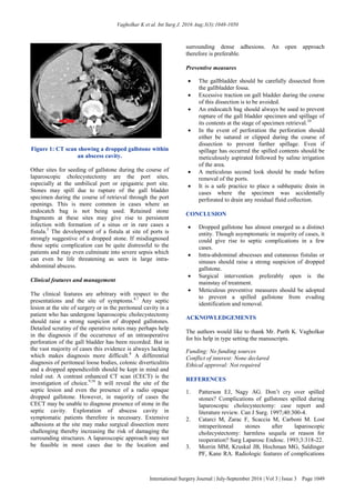 Dropped gall stones:An entity in evolution | PDF