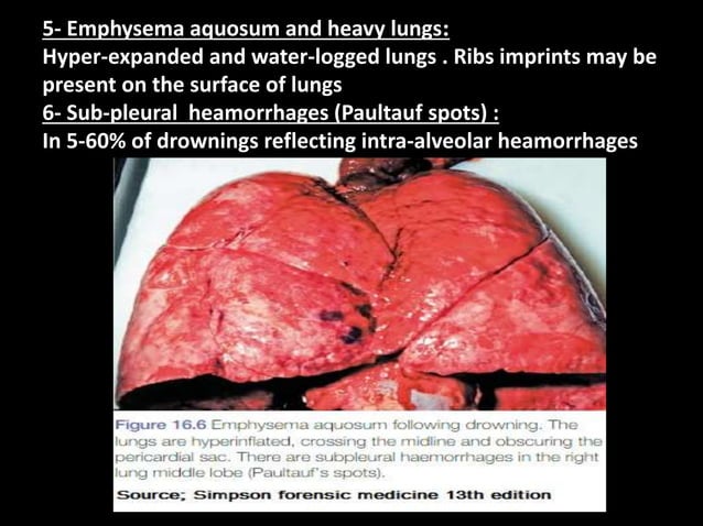 Drowning | PPTX | First Aid | Injuries