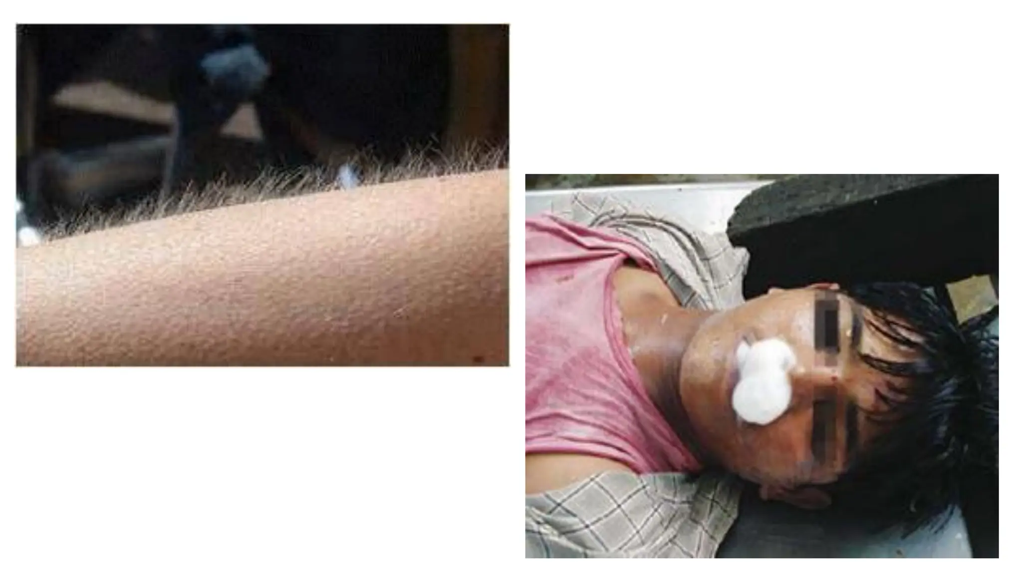 Drowning case for forensic medicine scenario .pdf