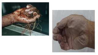 Drowning case for forensic medicine scenario .pdf