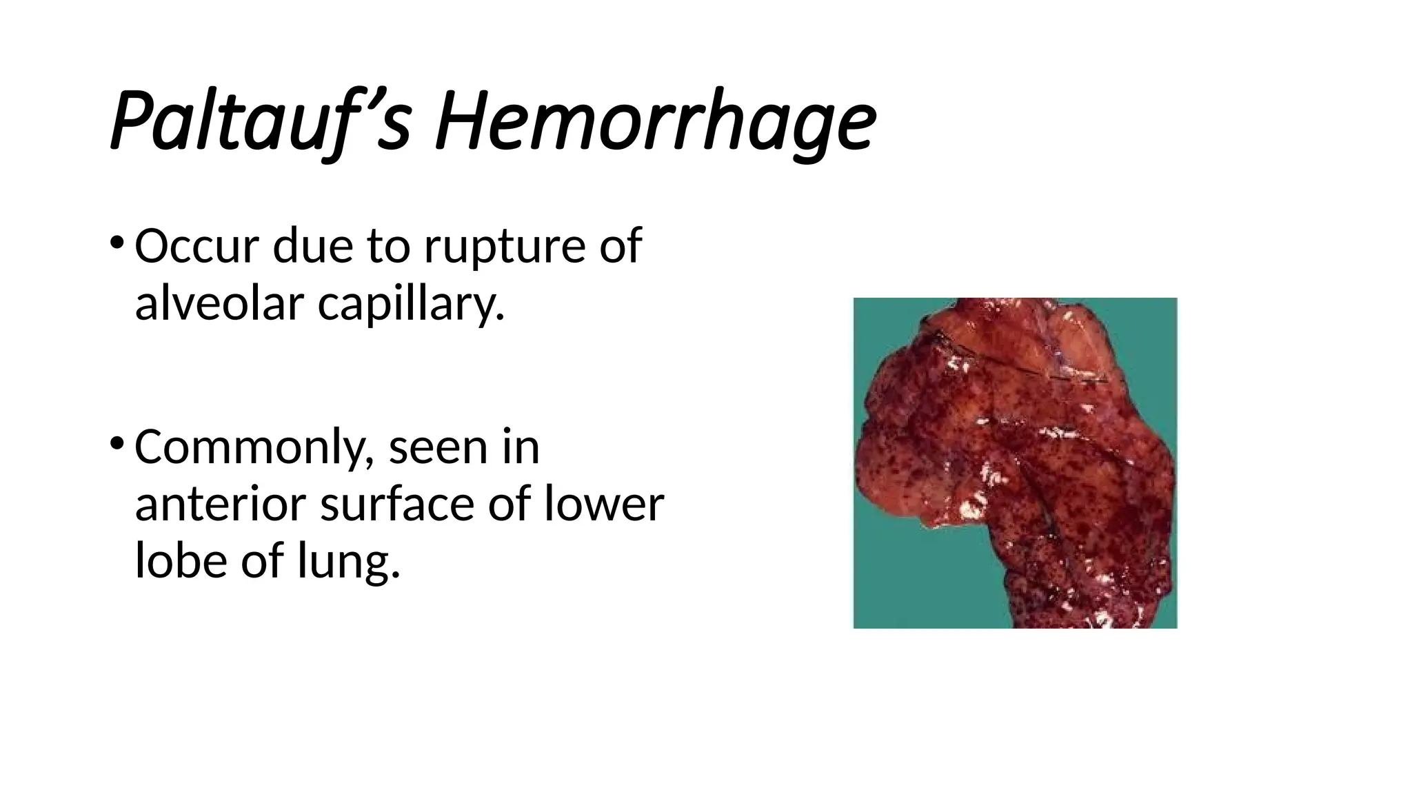 Drowning A detailed Case Study from postmortem examination | PPTX