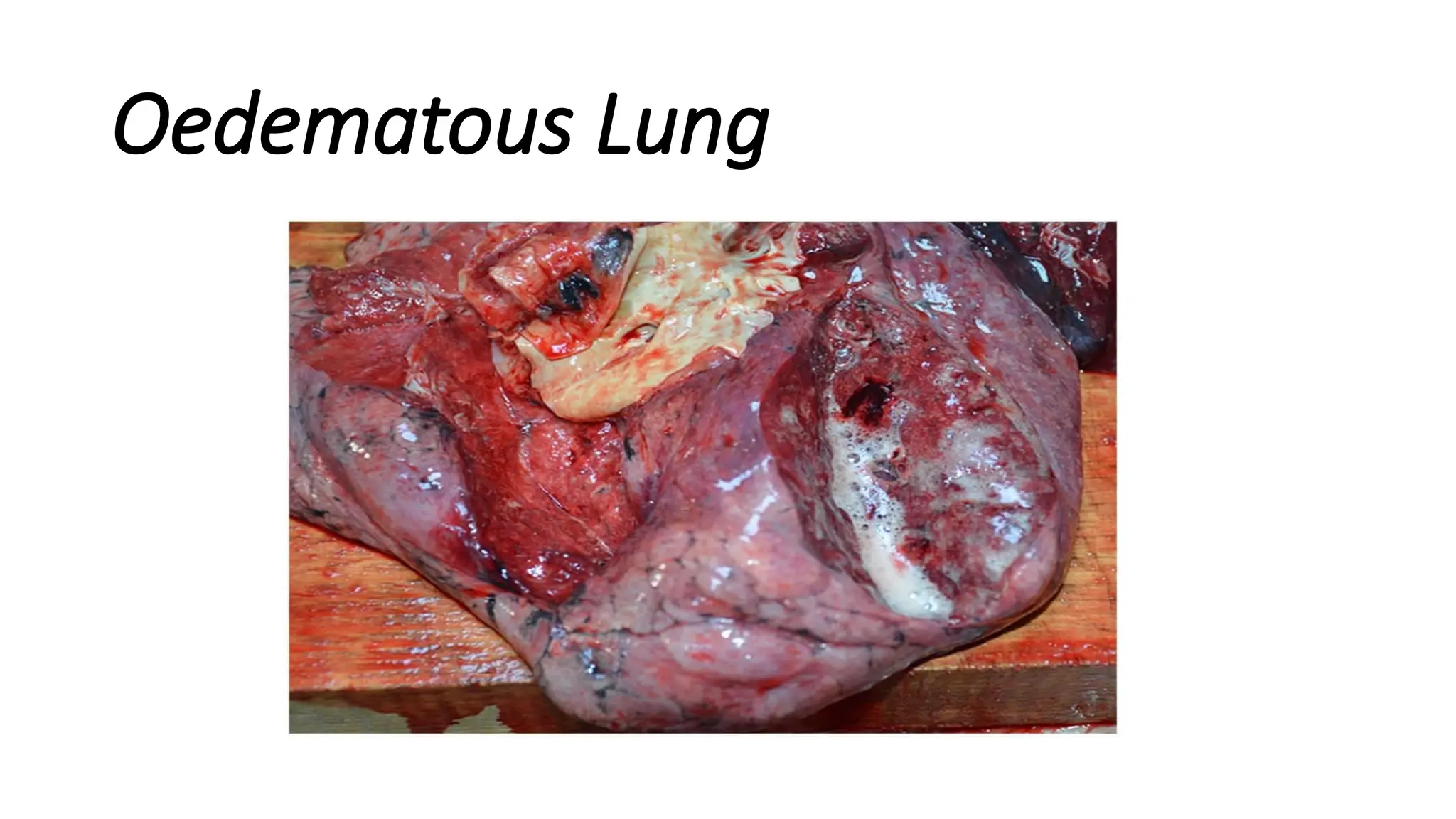 Drowning A detailed Case Study from postmortem examination | PPTX