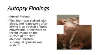 Drowning A detailed Case Study from postmortem examination | PPTX