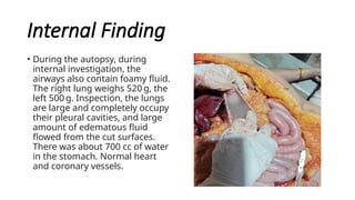 Drowning A detailed Case Study from postmortem examination | PPTX