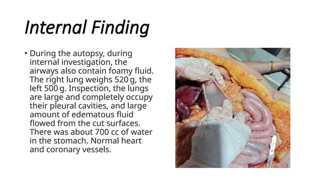 Drowning A detailed Case Study from postmortem examination | PPTX