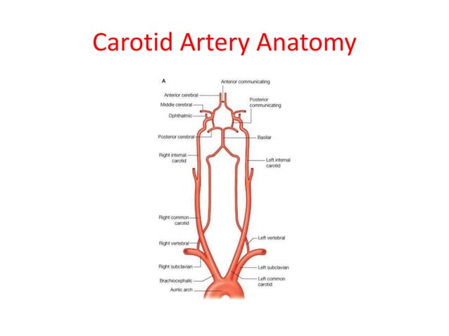 Carotid Artery Stenosis Dr Pankaj Rathi DM Traine Shri Aurobindo ...