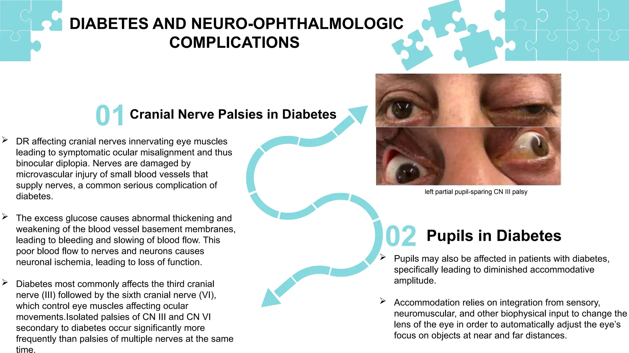 Pathogenesis of Diabetic Retinopathy .pptx