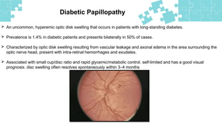 Pathogenesis of Diabetic Retinopathy .pptx