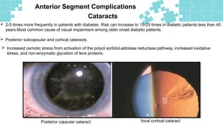 Pathogenesis of Diabetic Retinopathy .pptx