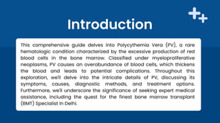 Comprehensive Guide to Polycythemia Vera: Symptoms, Causes, and ...