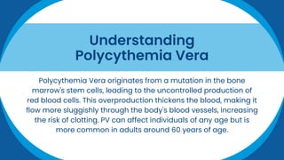 Comprehensive Guide to Polycythemia Vera: Symptoms, Causes, and ...