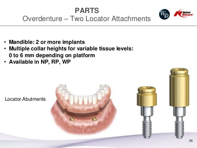 Implant Supported Over Denture By Dr pitzak