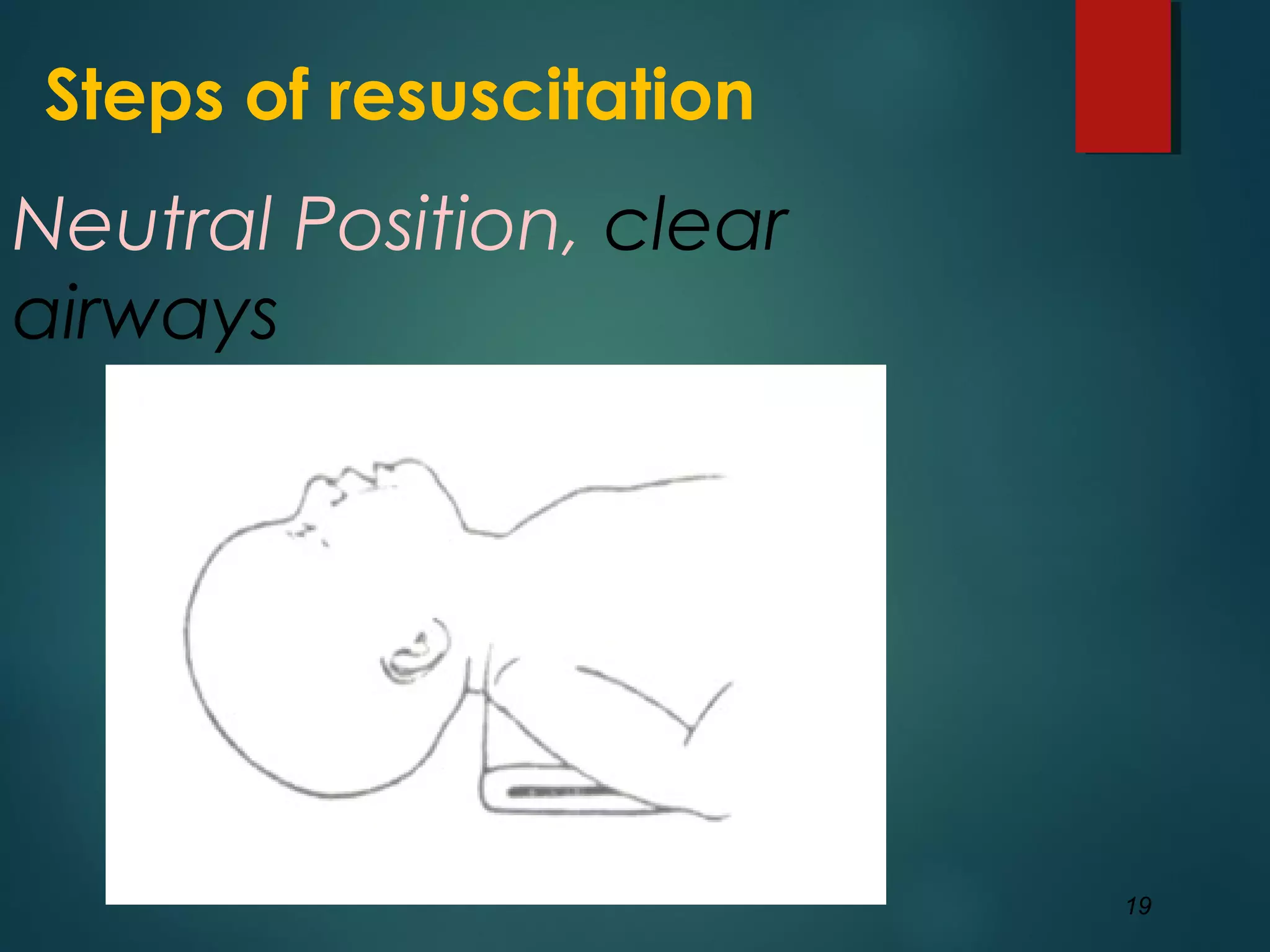 Dr pjca mbizi resuscitation | PPT