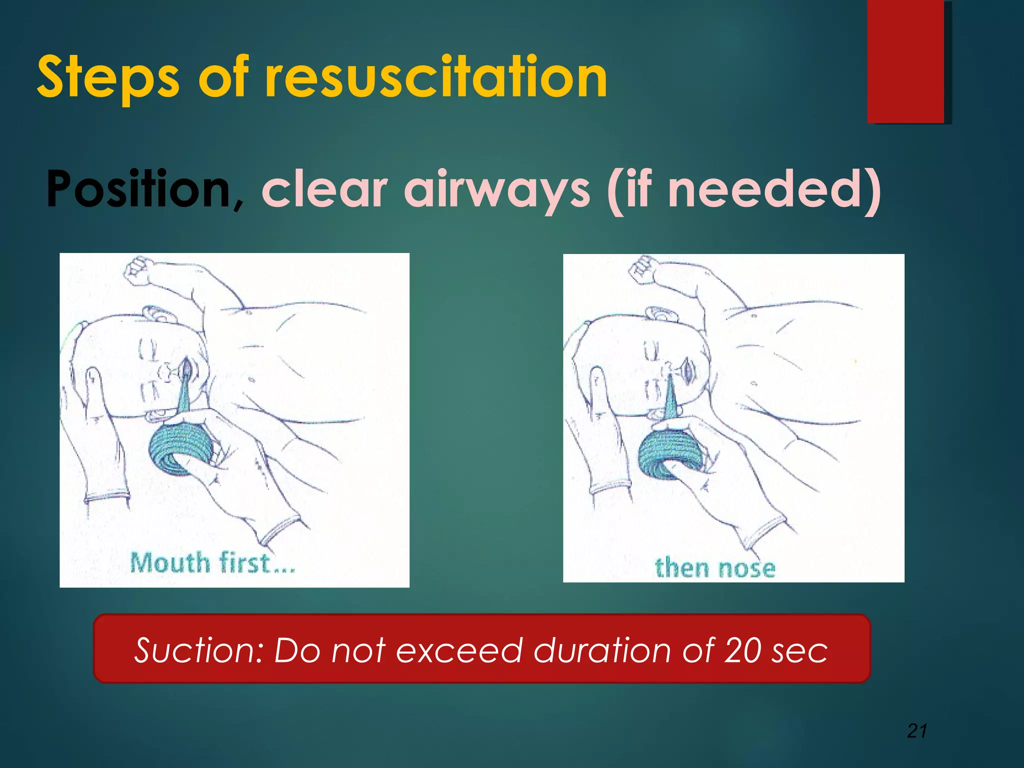Dr pjca mbizi resuscitation | PPT