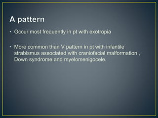 Pattern Strabismus | A.V Pattern | PPTX
