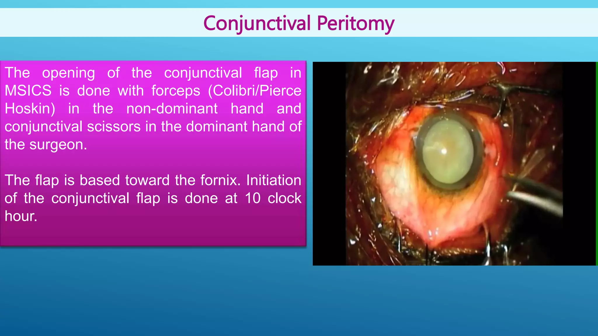 Dr Prakash Bam MSICS.pptx