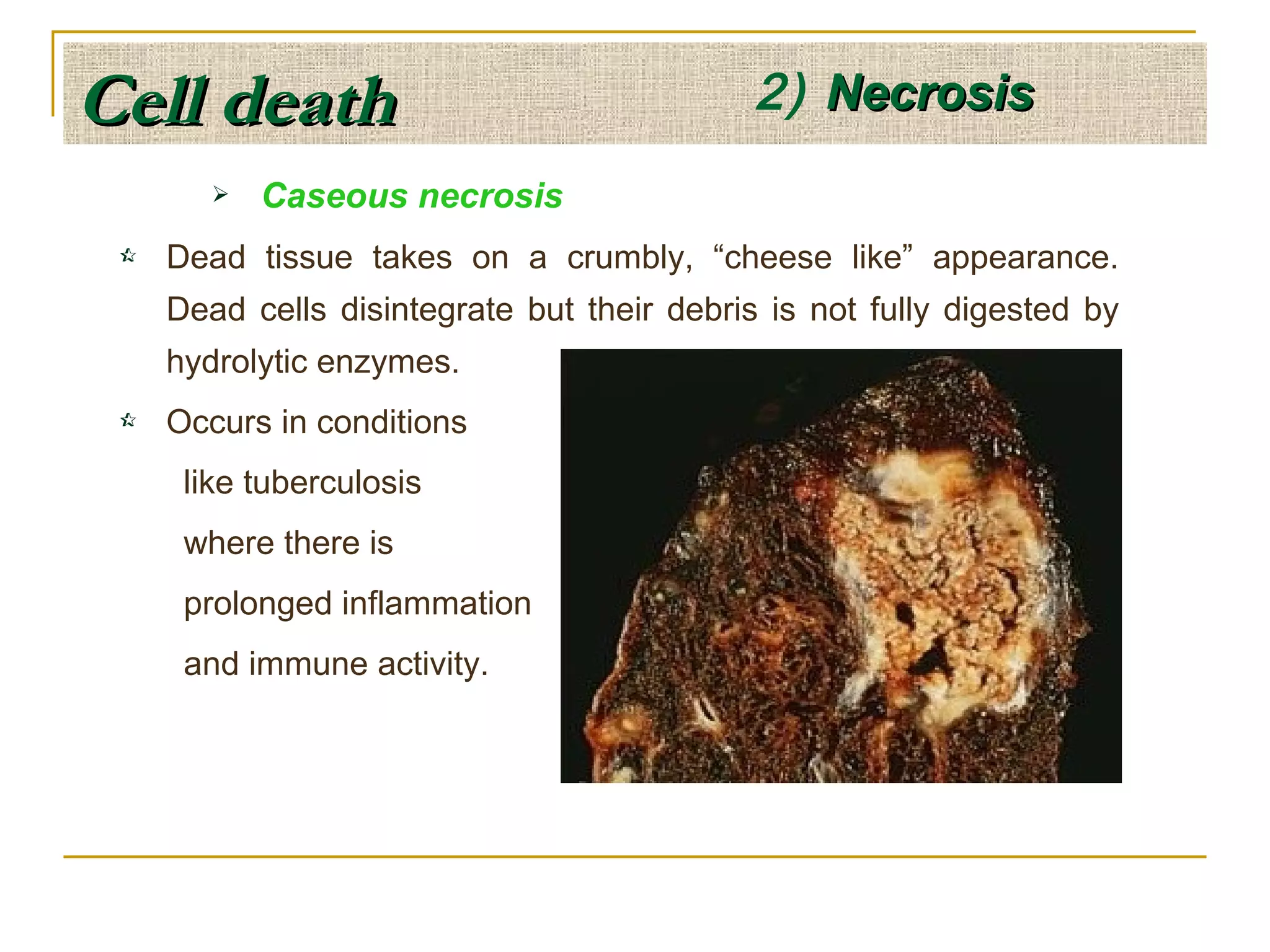 Dr prashanth jain;basic pathology | PPT