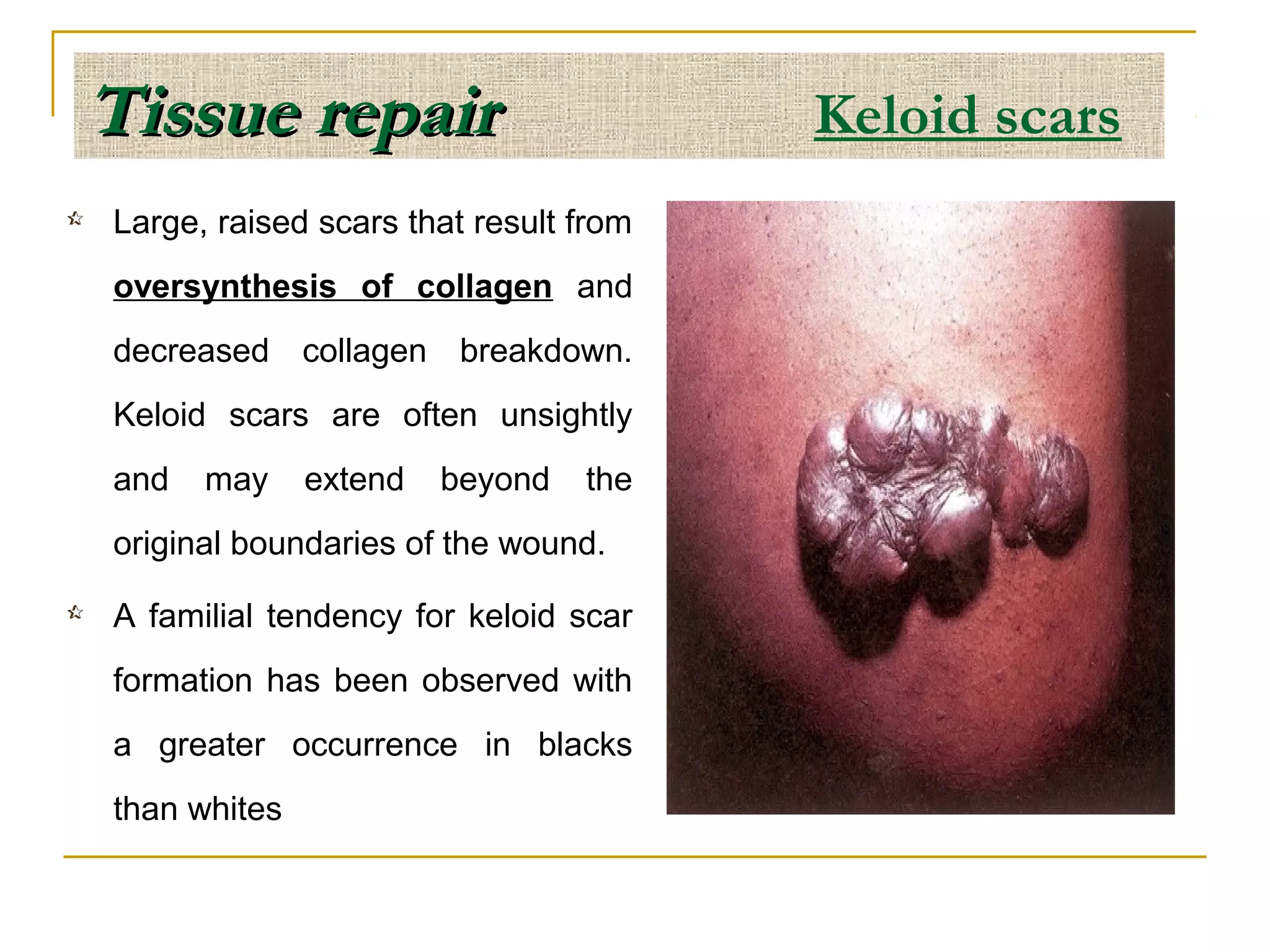 Dr prashanth jain;basic pathology | PPT