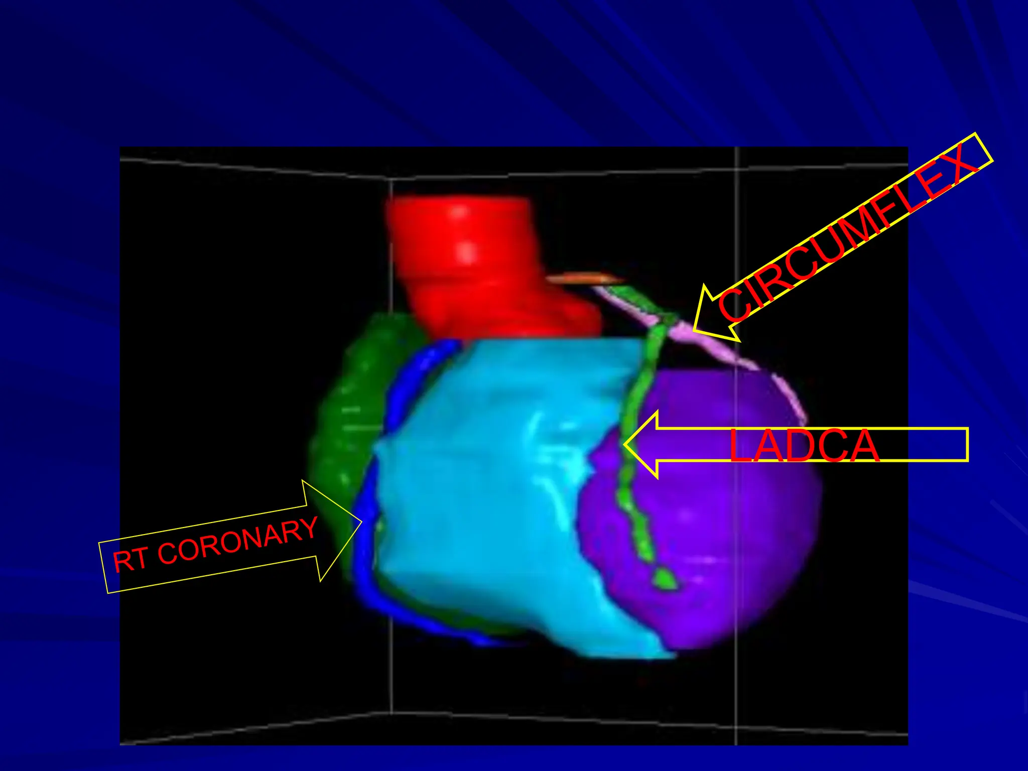 radiation therapy for students,contouring breast | PPT