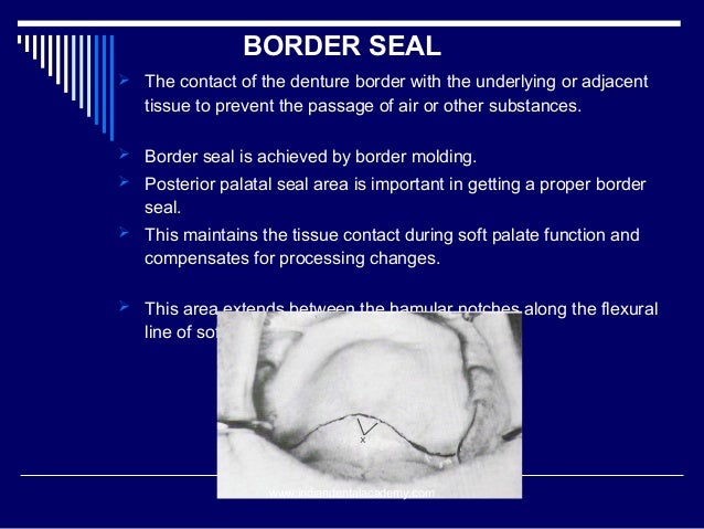 retention complete dentures/certified fixed orthodontic courses by