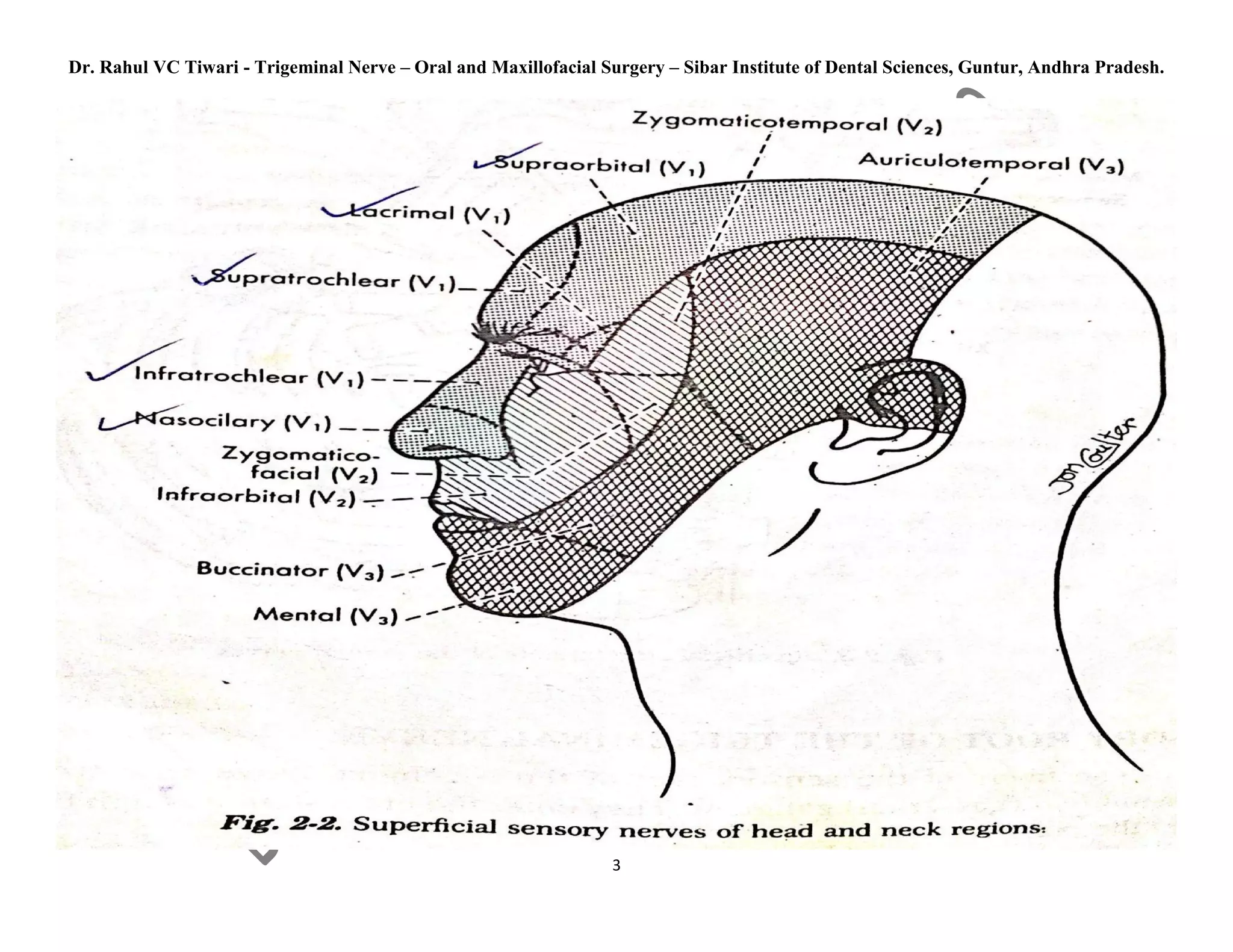 Dr RAHULVC TIWARI Diagrams of intracranial and extracranial course of ...