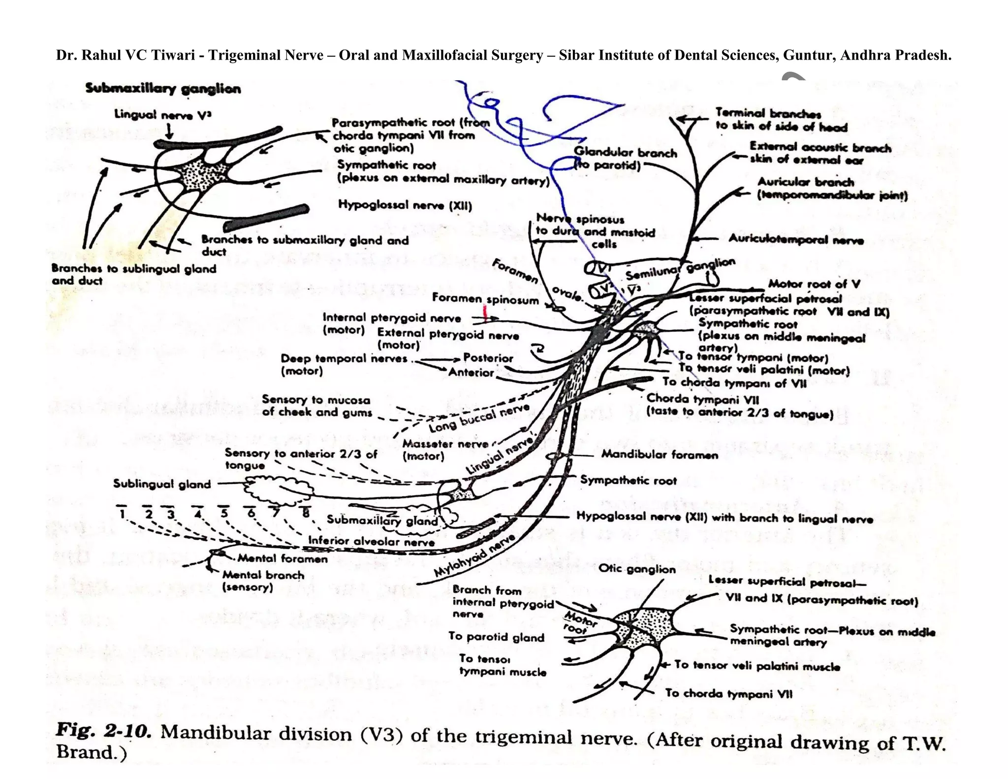 Dr RAHULVC TIWARI Diagrams of intracranial and extracranial course of ...