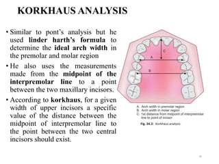 Model Analysis | PPT