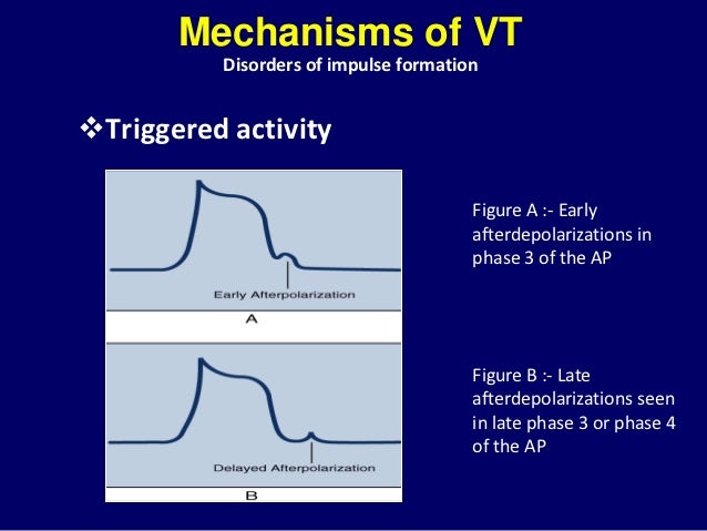 Dr ranjith mp,ventricular tachycardia in abnormal heart dr ranjith mp