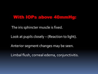 Acute Rise in IOP (Dr. Rasha, senior resident of ophthalmology) | PPTX