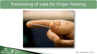 Dr ravari finger feeding, dropper, spoon, syringe and bottle feeding | PDF