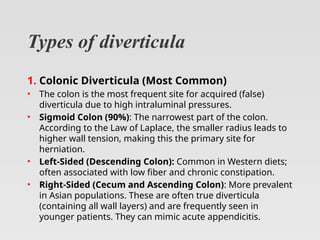Dr Ravi Kumar Meena Diverticulitis..pptx