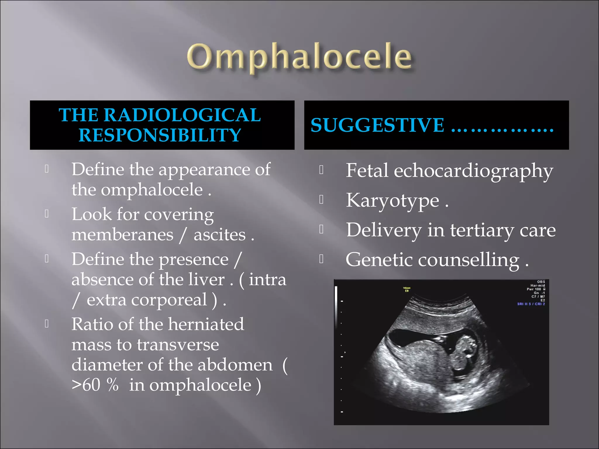 fetal imaging omphalocele | PPT