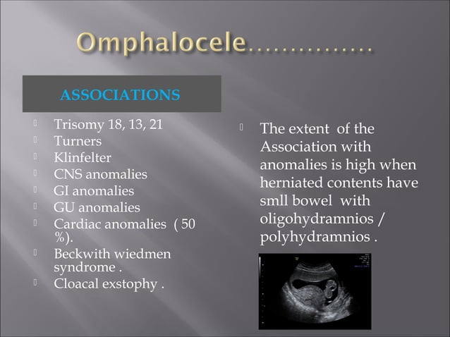 fetal imaging omphalocele | PPT