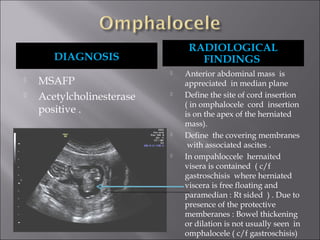 fetal imaging omphalocele | PPT