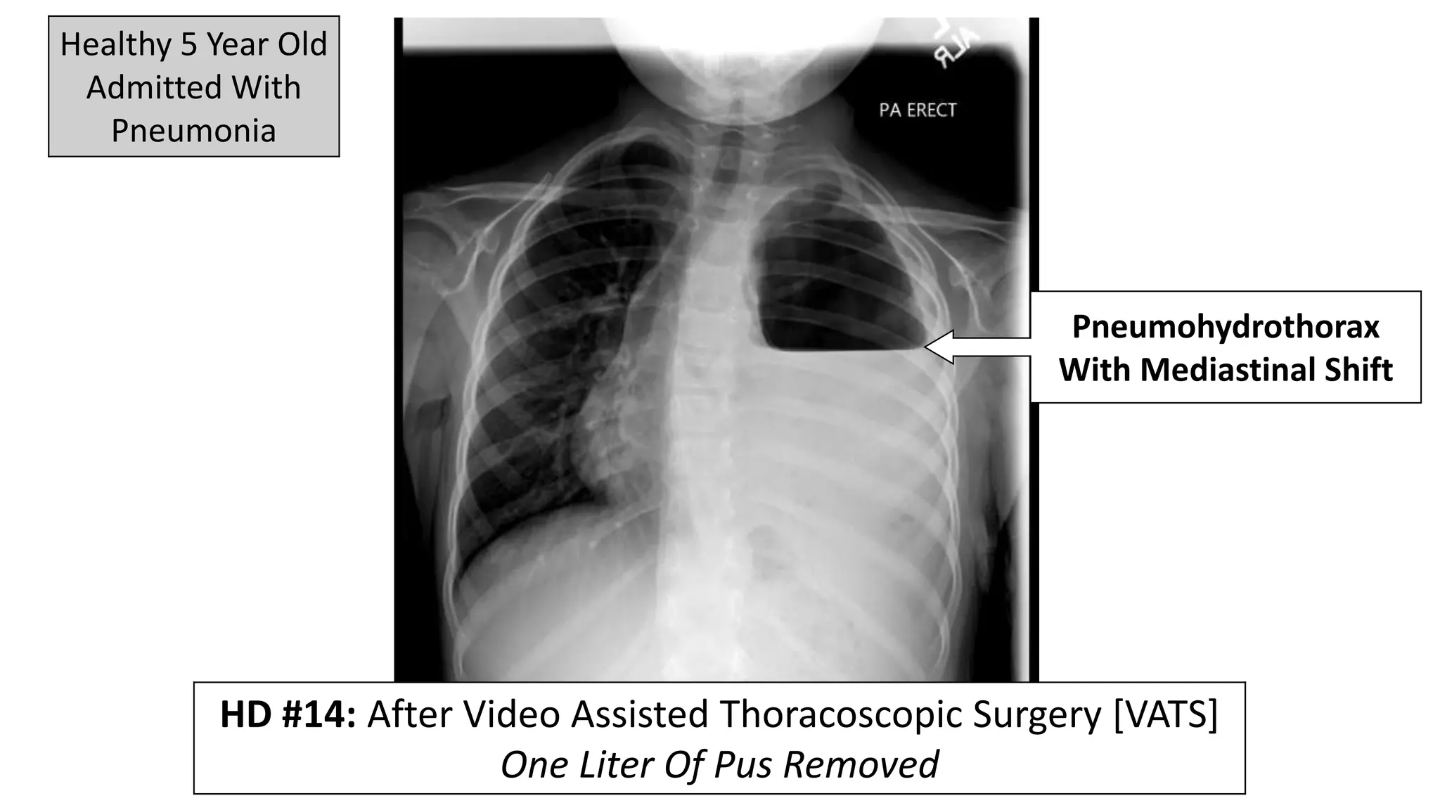 Drs. Potter and Richardson's CMC Pediatric X-Ray Mastery week 1 | PPT