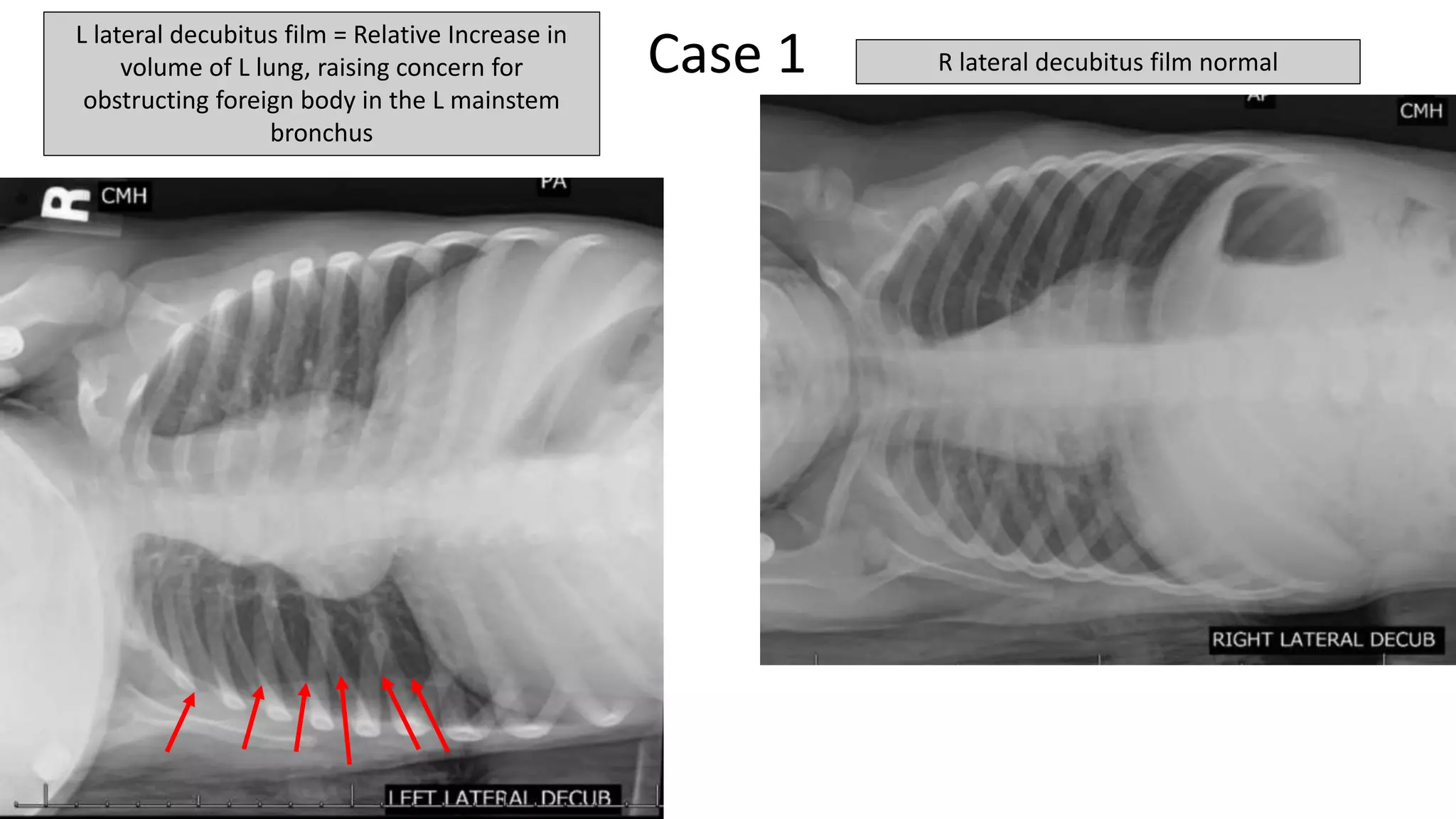 Drs. Potter and Richardson's CMC Pediatric X-Ray Mastery week 1 | PPT