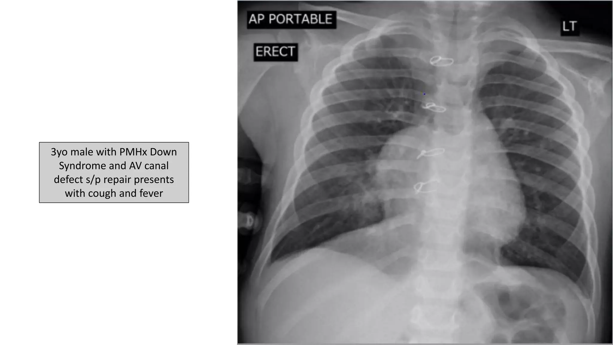 Drs. Potter and Richardson's CMC Pediatric X-Ray Mastery week 1 | PPT