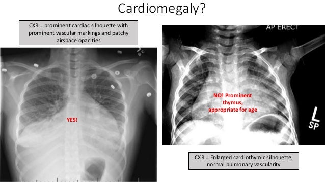 Drs. Potter and Richardson's CMC Pediatric X-Ray Mastery week 1