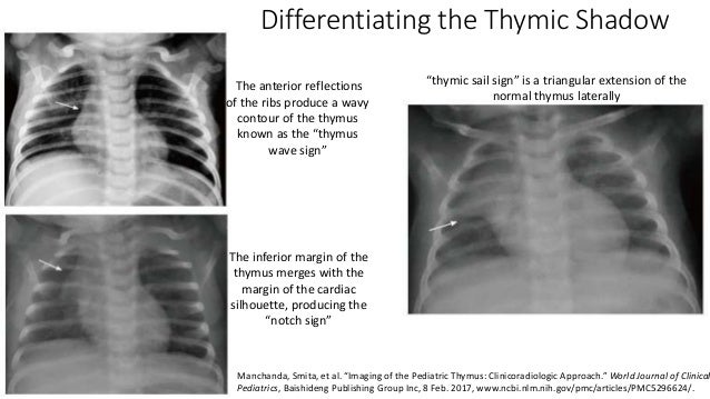Drs. Potter and Richardson's CMC Pediatric X-Ray Mastery week 1