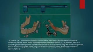 DR SAGAR.pptx | Free Download