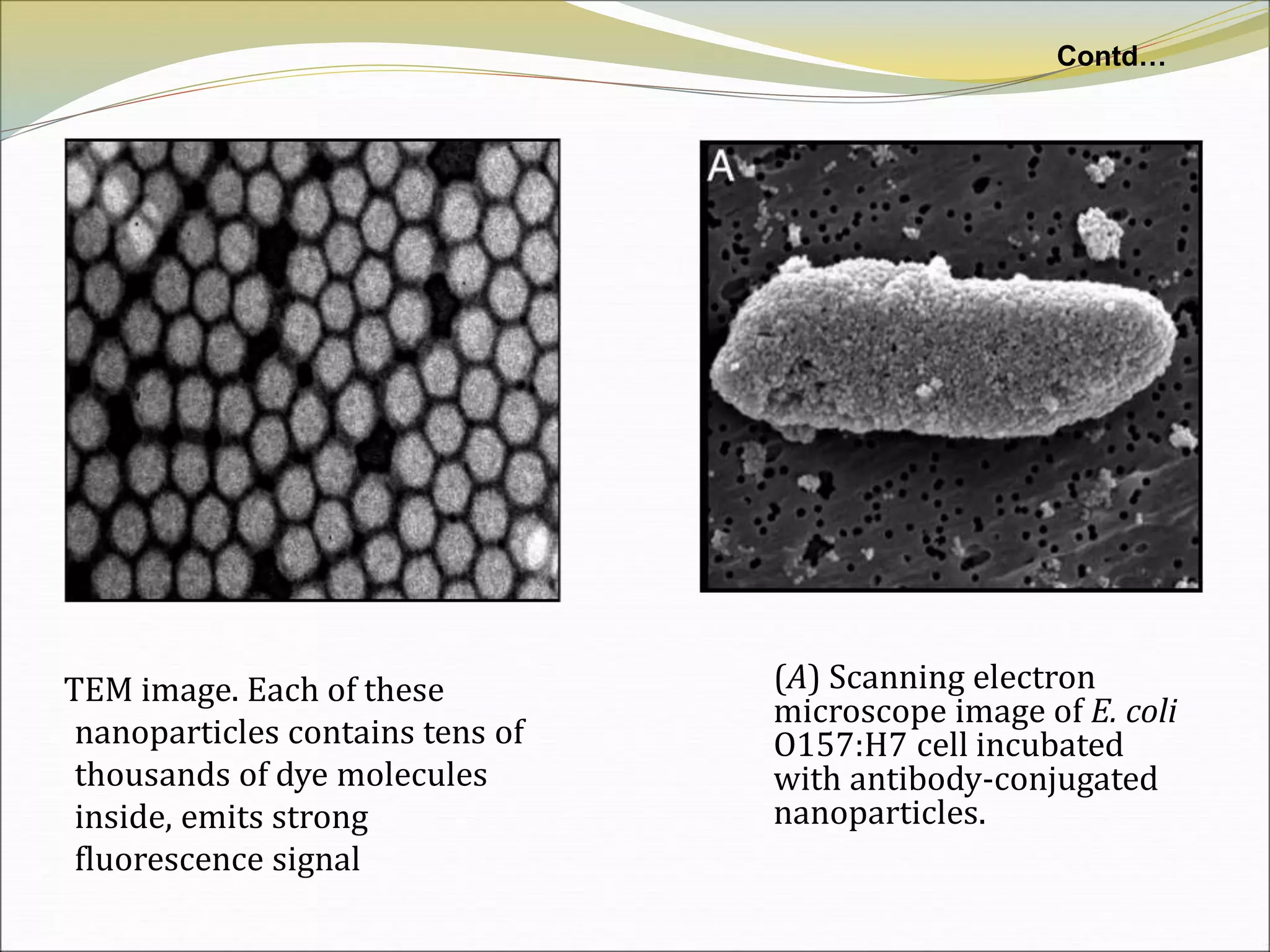 Nanoparticles & Its Use in Diagnosis of Bacterial Diseases | PDF
