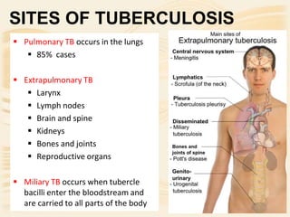 REPRODUCTIVE TRACT INFECTIONS DUE TO MTB | PPT
