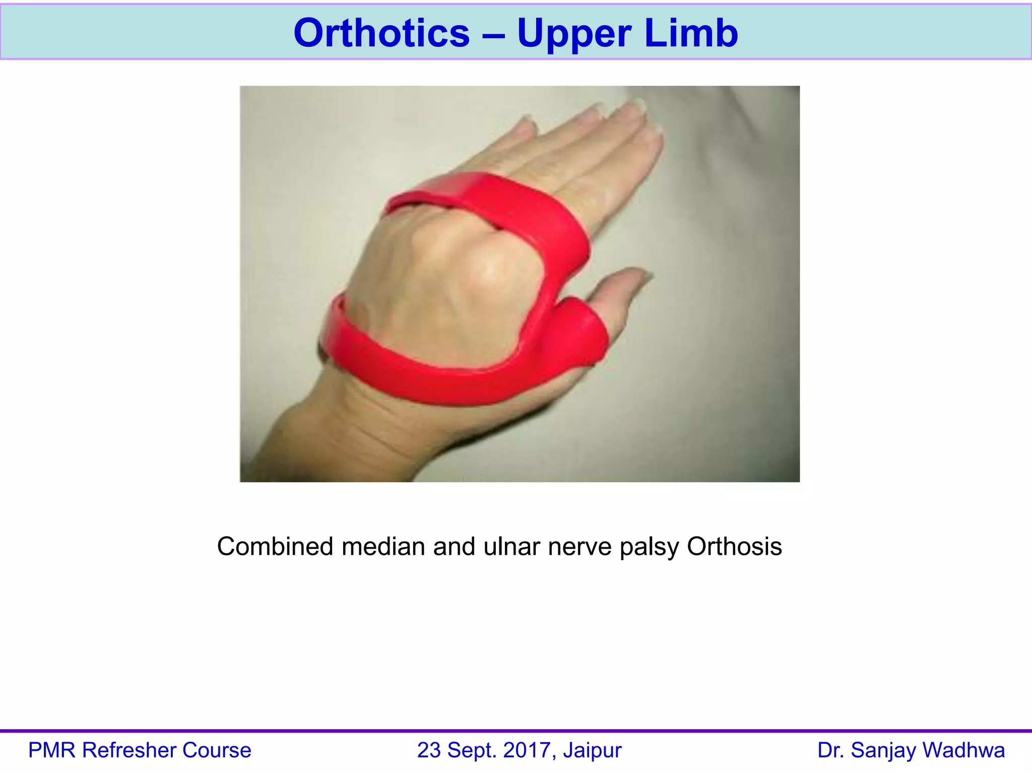 Upper Limb Orthotics - Dr Sanjay Wadhwa | PDF