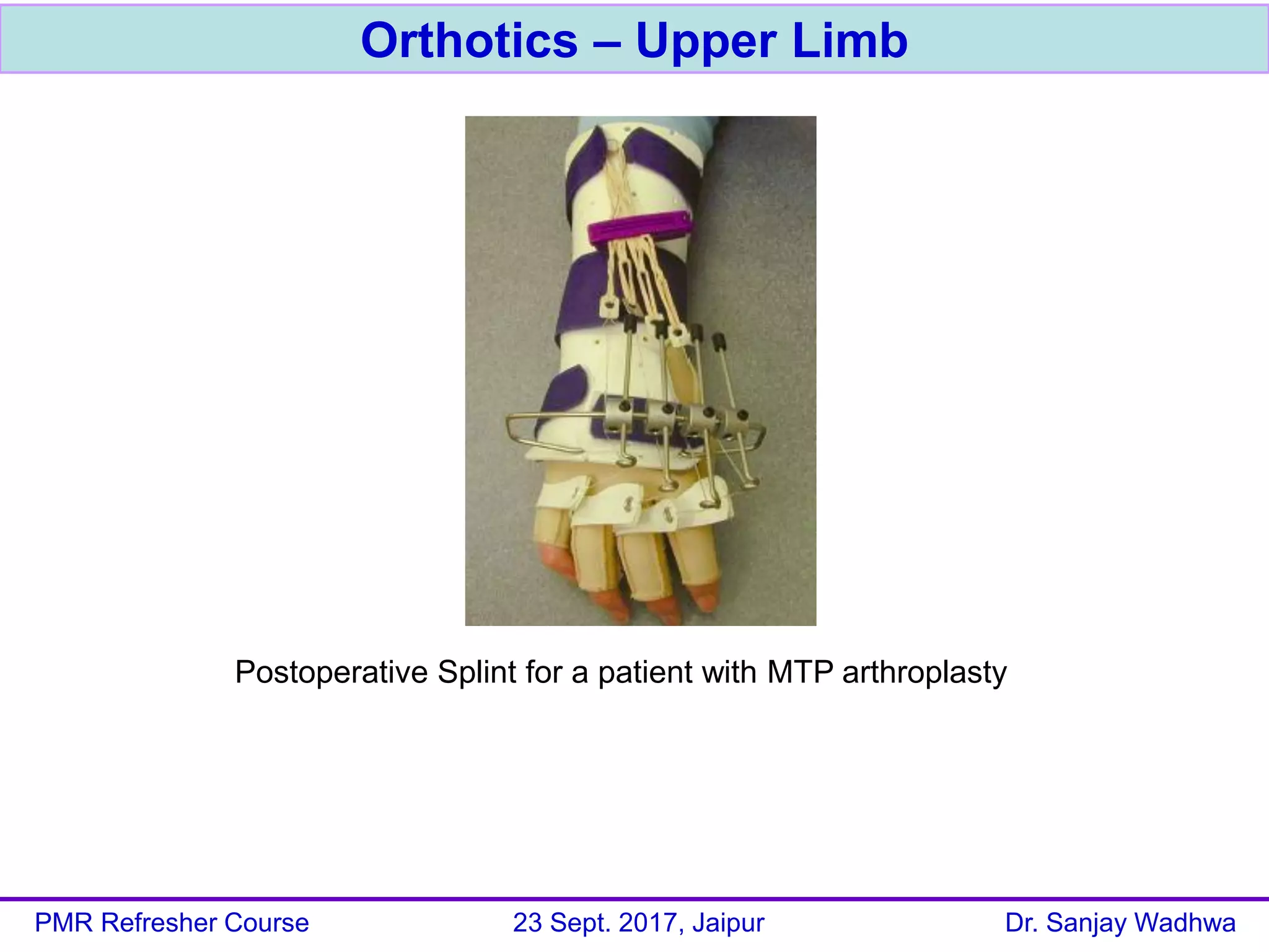 Upper Limb Orthotics - Dr Sanjay Wadhwa | PDF