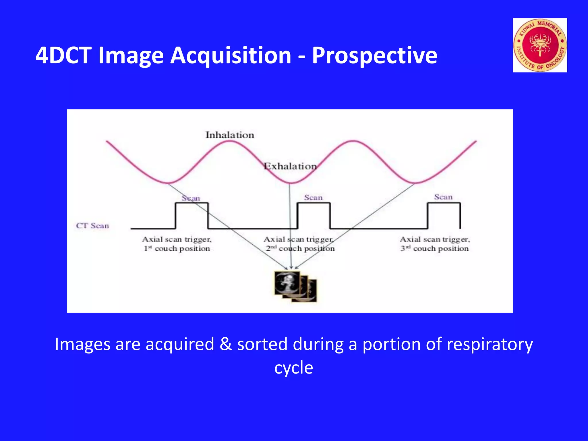 ABC system, Free Breath 4DCT & Symmetry Radiotherapy | PDF