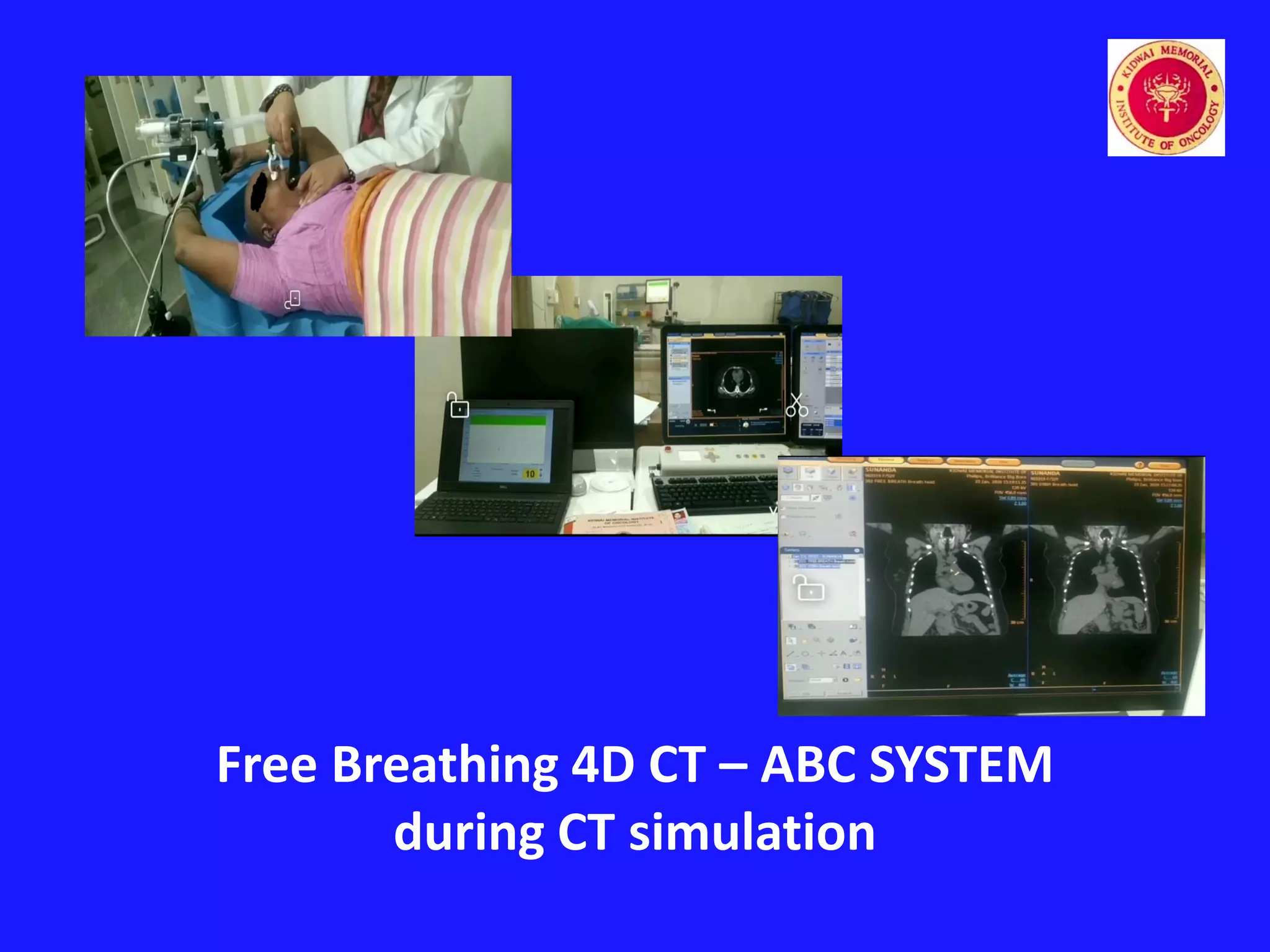 ABC system, Free Breath 4DCT & Symmetry Radiotherapy | PDF