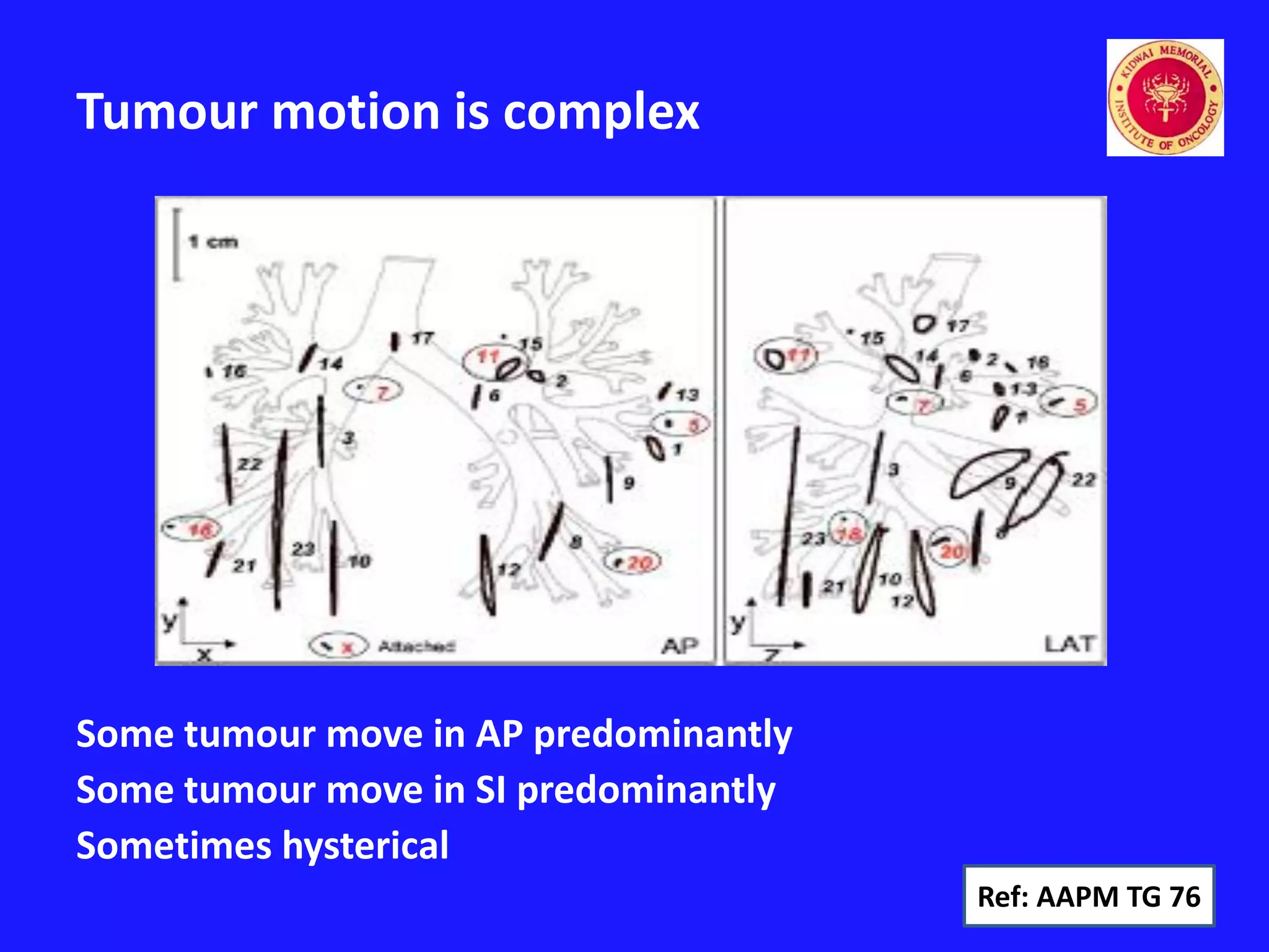 ABC system, Free Breath 4DCT & Symmetry Radiotherapy | PDF